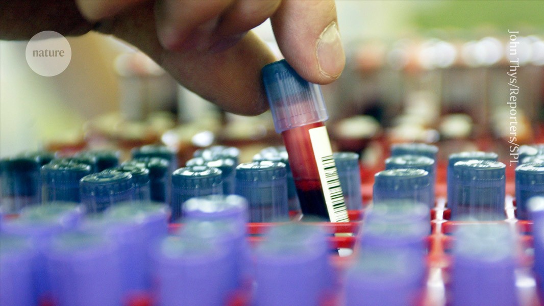 Bluttest zur Diagnose von Bipolarer Störung – Skepsis unter Forschern ...